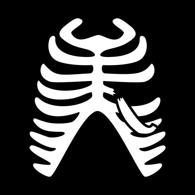 Funny - Get Well Gift Fractured Broken Rib - Broken Rib - Phone Case ...