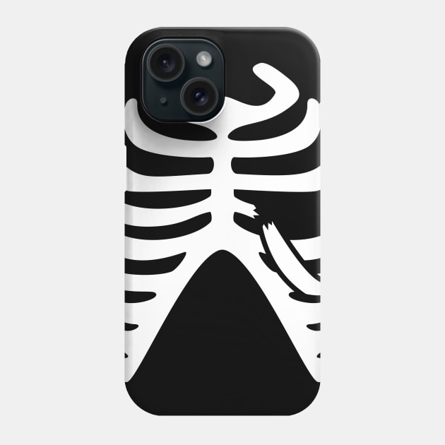 Funny - Get Well Gift Fractured Broken Rib - Broken Rib - Phone Case ...