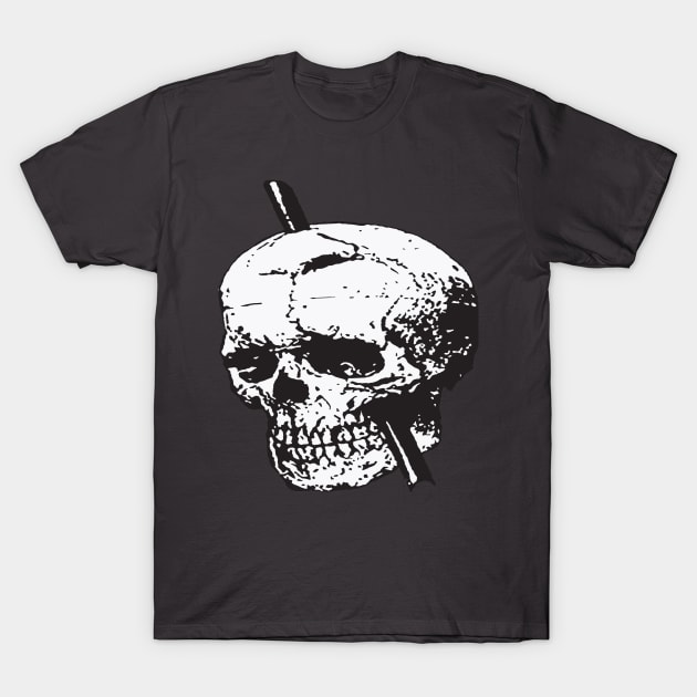 Black and White Skull of Phineas Gage With Tamping Iron - Human Skull ...