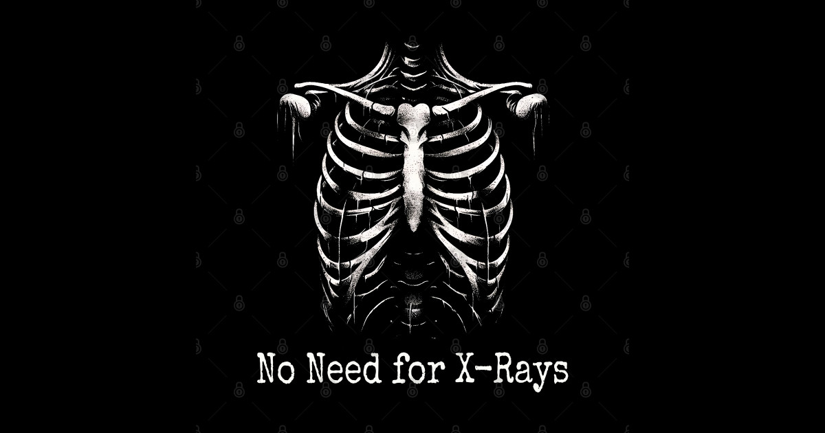 Creepy Grunge Rib Cage X-Rays - Rib Cage X Rays - Posters and Art ...