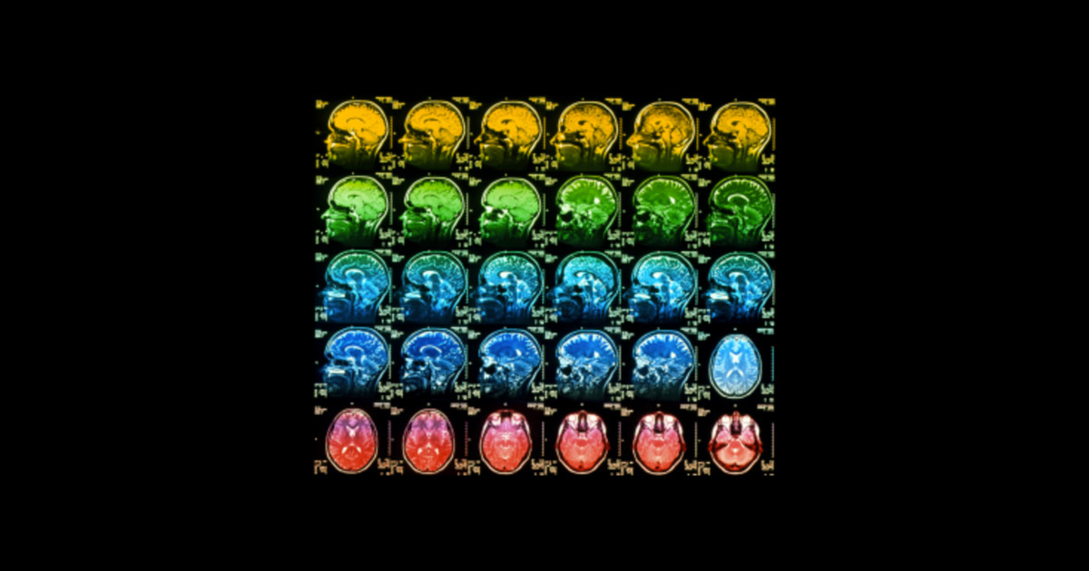 Coloured MRI scans of a healthy human brain (P332/0331) - Multiple View ...