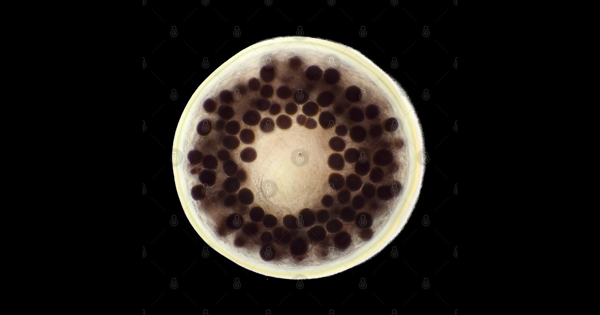 Pollen grain (spore) from air sample under the microscope - Light ...