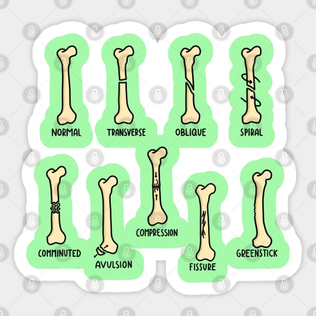 Hand Drawn Types of Fractures Black Text - Fracture - Sticker | TeePublic