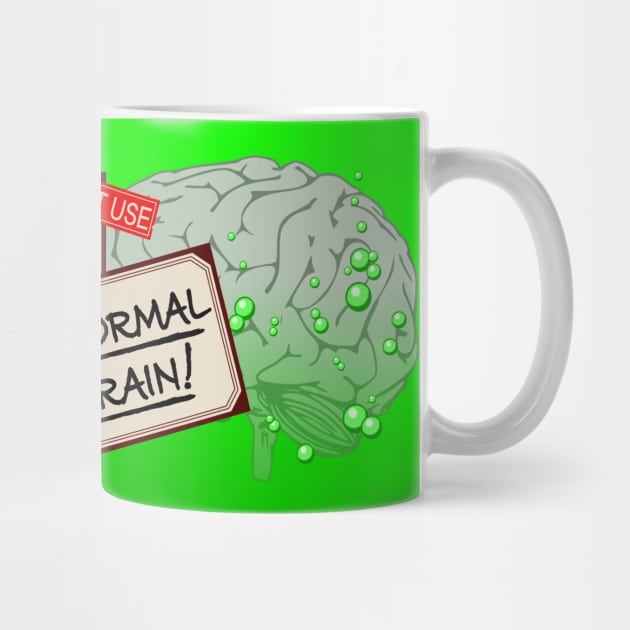 Abnormal Brain! - Young Frankenstein - Mug | TeePublic