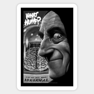 marty feldman abnormal