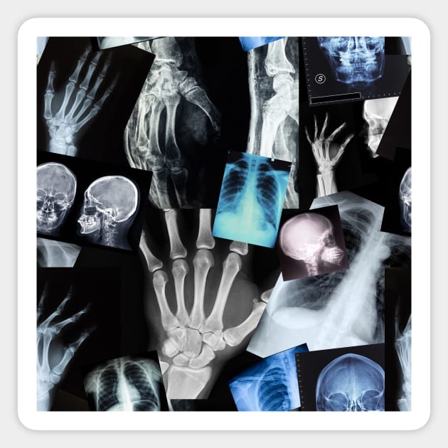 X Ray Pattern - Human Anatomy - Xray - Sticker | TeePublic