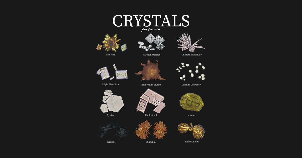 Medical Lab Urine Crystal Laboratory Tech Science Teacher - Medical Lab ...