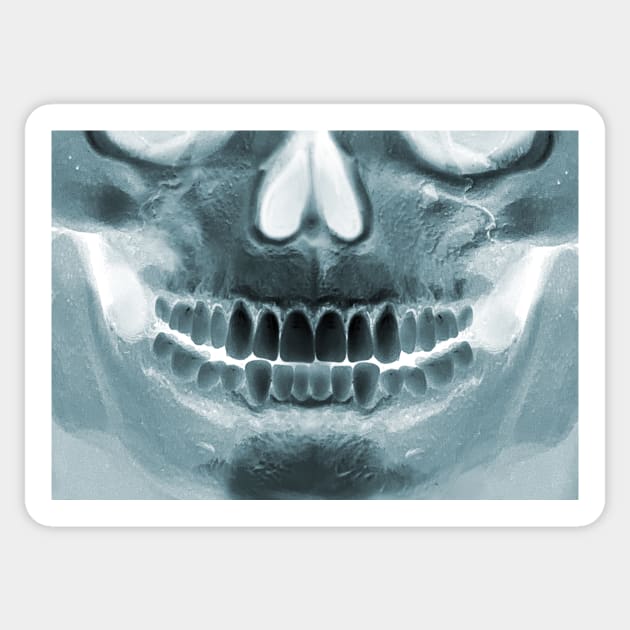 Killer Masks - Skull X-Ray - Skull - Sticker | TeePublic