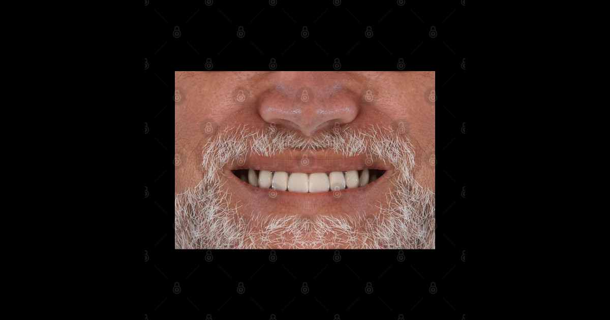 Hide the Pain Harold Meme - Sad Guy Facemask - Hide The Pain Harold ...