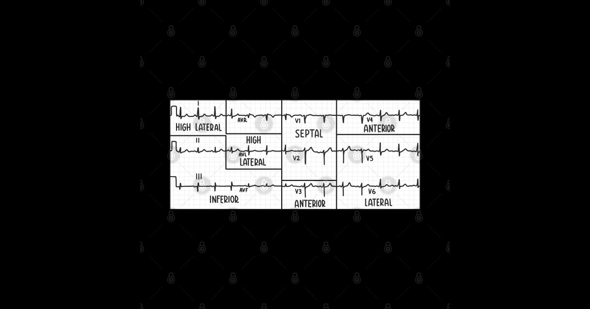 Hand Drawn 12 Lead Electrocardiogram (ECG) Black - Pre Med - Sticker ...