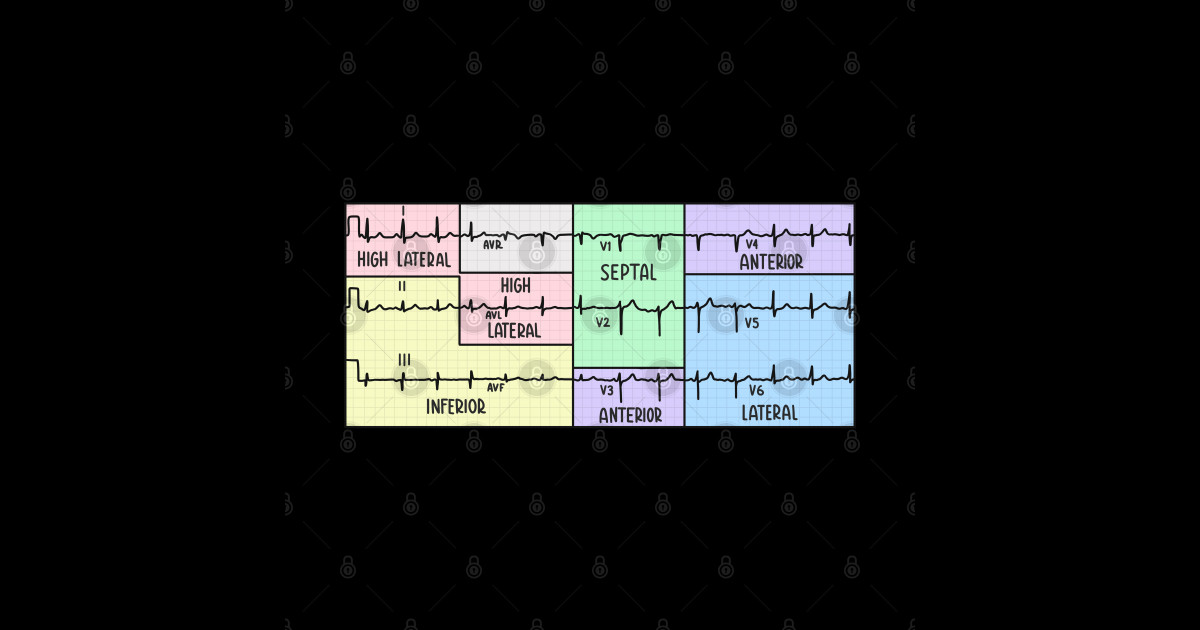Hand Drawn Electrocardiogram (ECG) Pastel - Pre Med - Sticker | TeePublic
