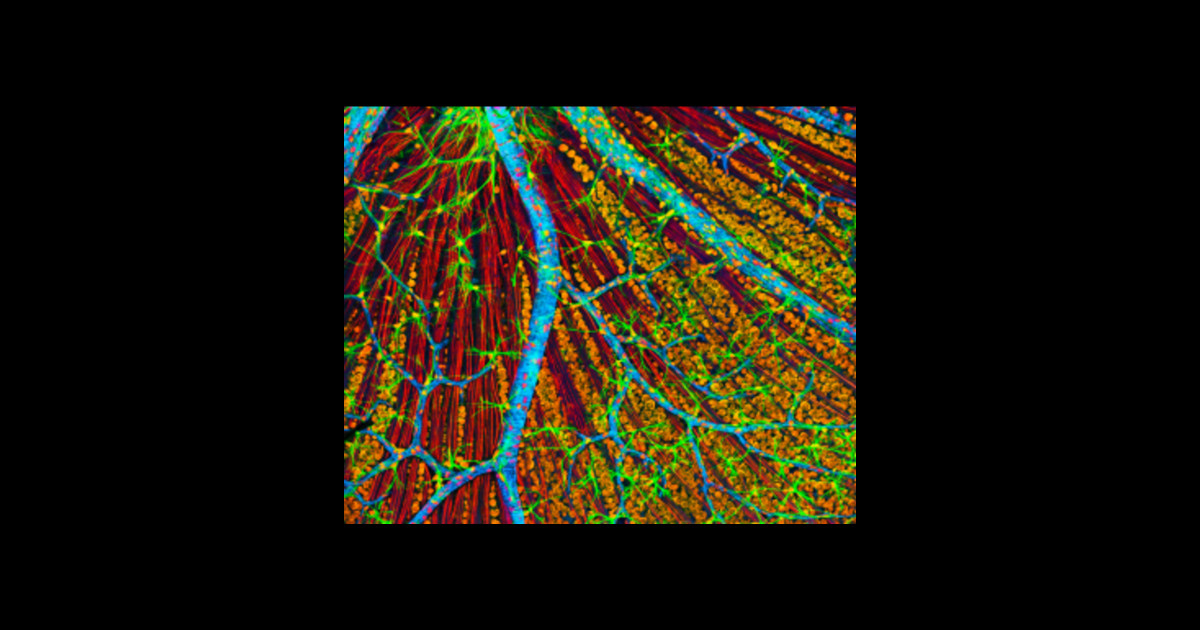 Retina blood vessels and nerve cells (P424/0244) - Nerve Cell - Hat ...