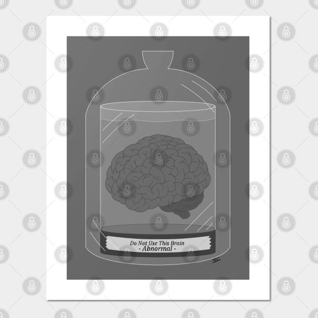 Abnormal Brain - Young Frankenstein - Posters and Art Prints | TeePublic