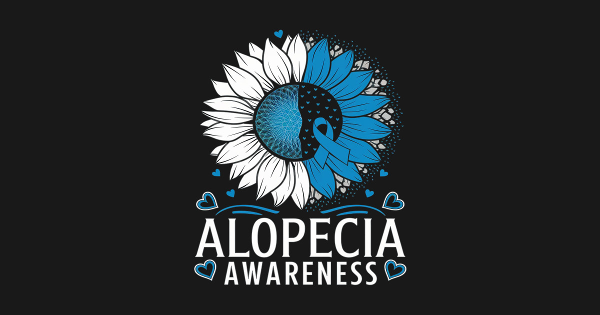 We Wear Blue Alopecia Areata Awareness Month - We Wear Blue Alopecia ...