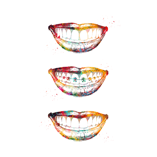 Before, with and after braces - Braces - T-Shirt | TeePublic