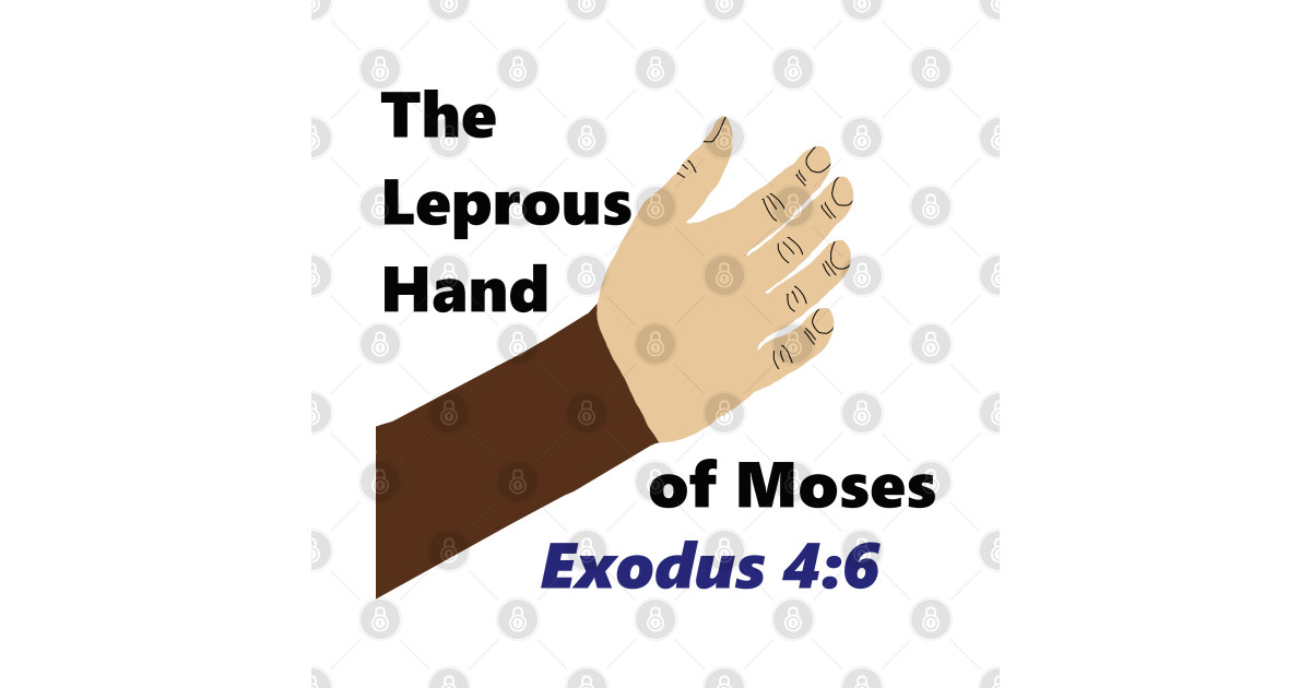 Moses was Black - The Leprous Hand of Moses - Exodus 4:6 - Put now ...