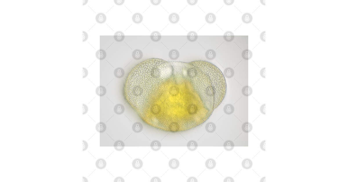 Conifer pollen grain under the microscope - Conifer Pollen - T-Shirt ...