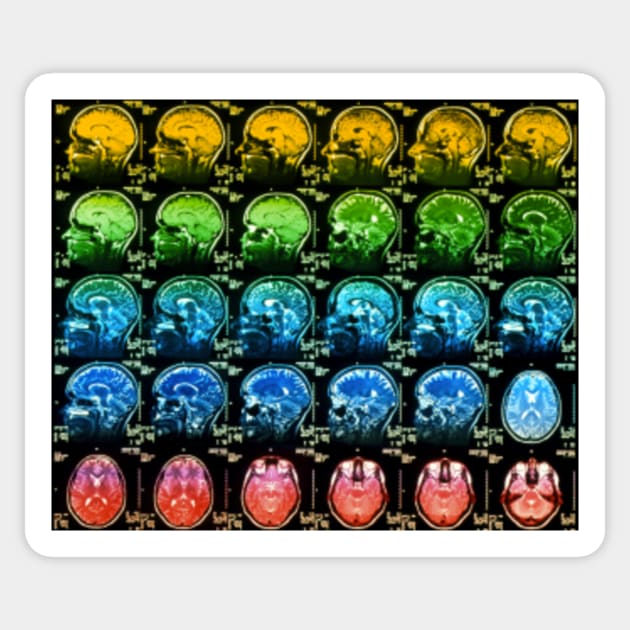 Coloured MRI scans of a healthy human brain (P332/0331) - Multiple View ...