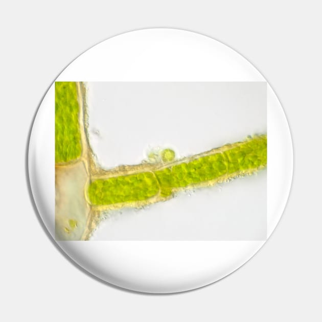 Plant cells under the microscope, showing chlorophyll content ...