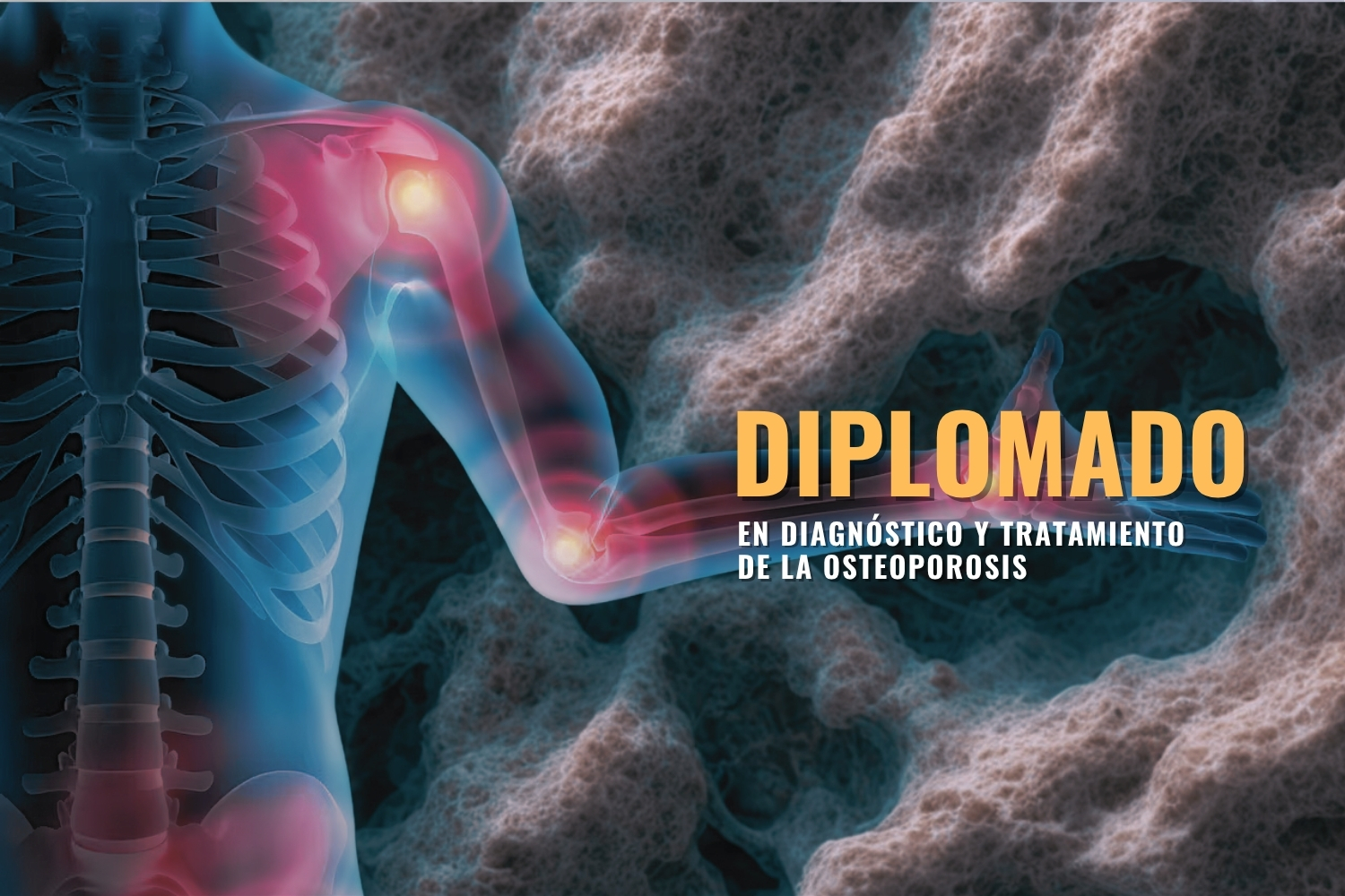 Ammom Asociación
