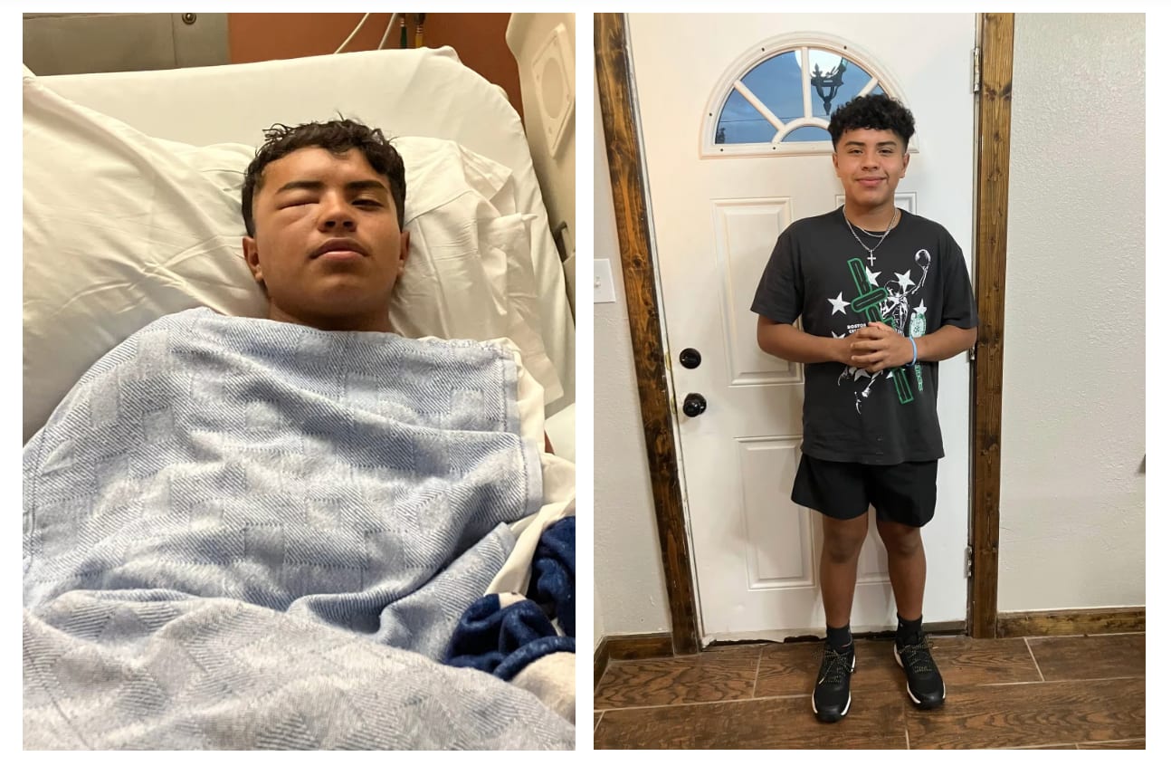 A Split-Second Accident, A Remarkable Recovery