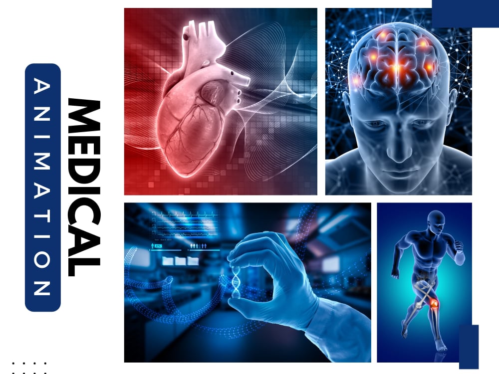 Detailed Medical animations explaining the Medical Procedures & 3D ...