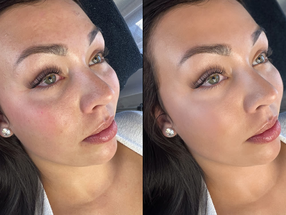 Master Photo Editor: Retouch & Enhance Images. | Upwork