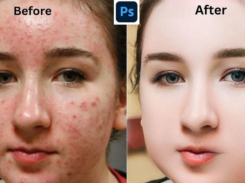 Face retouching, image editing, any kind of Photoshop editing | Upwork