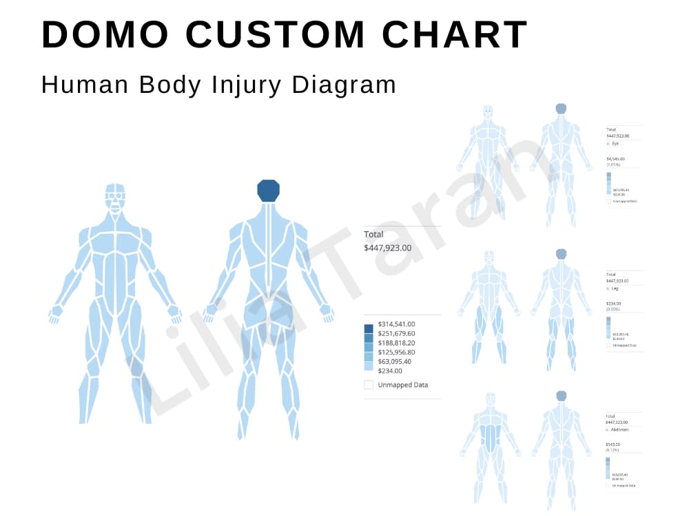 A Custom Domo Chart to Visualize Human Body Injuries | Upwork