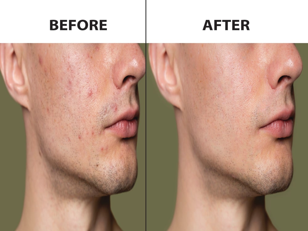 Captivating Profile Images: Professionally Edited Photos for Social ...