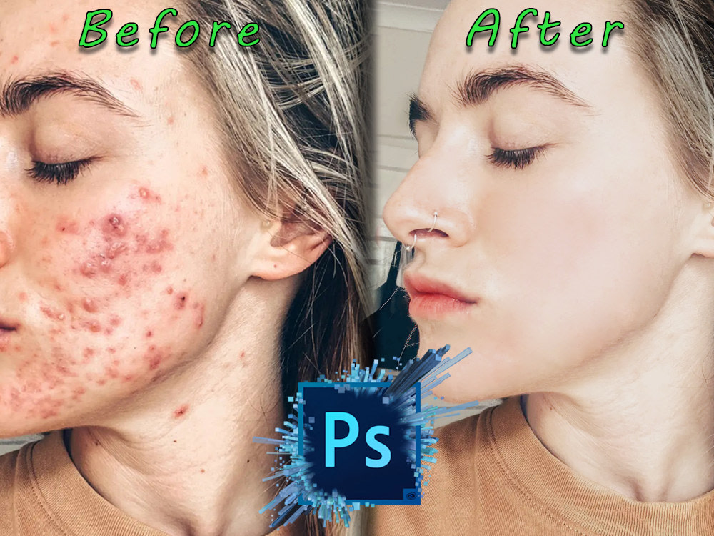 Face Editing project, skin restoration and background removal | Upwork