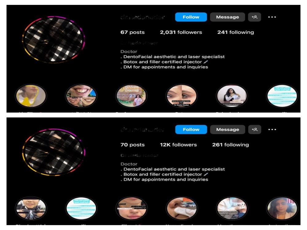 50% Discount. Instant Instagram Growth [Followers, Views, Likes ...