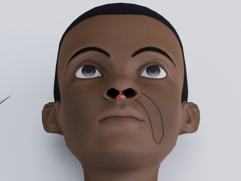 Detailed Medical animations explaining the Medical Procedures & 3D ...