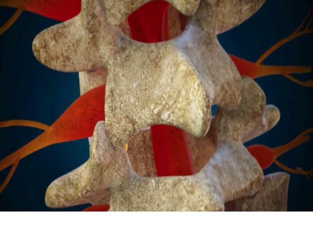 3d medical animation video, 3d medical animation medical surgery ...