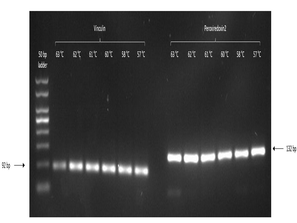 Accurate primer sets designed to fulfill your PCR requirements | Upwork