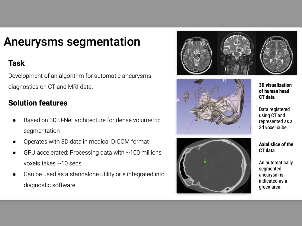 MVP for Detection/Classification/Segmentation/Regression projects | Upwork