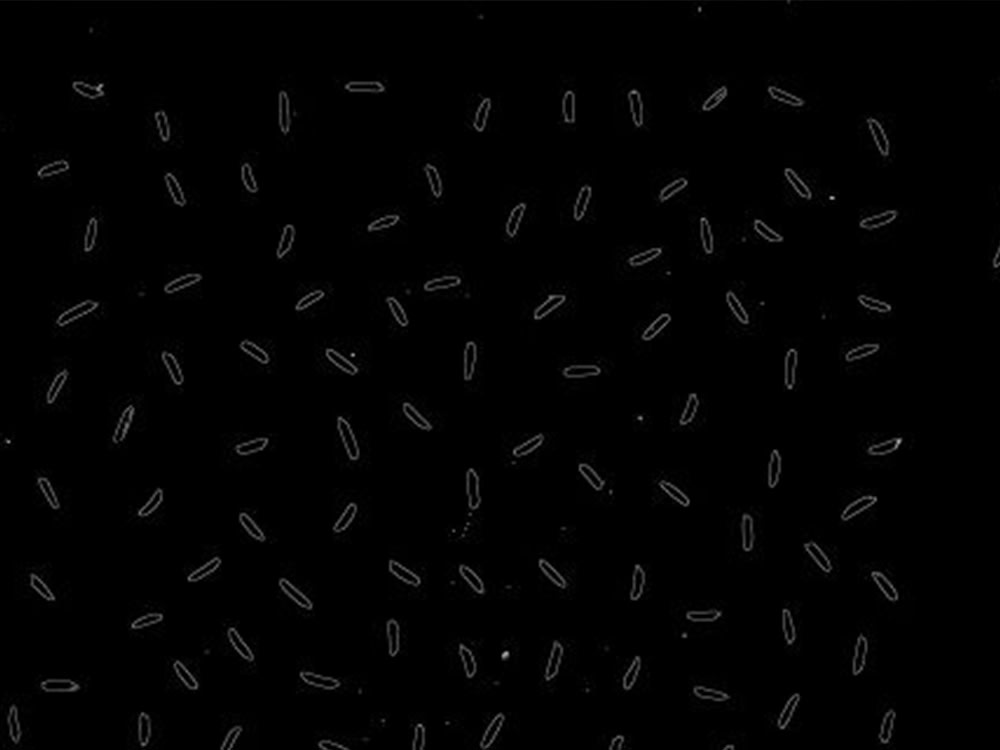 AI Solutions for Object Detection & Measurement using Image Processing | Upwork