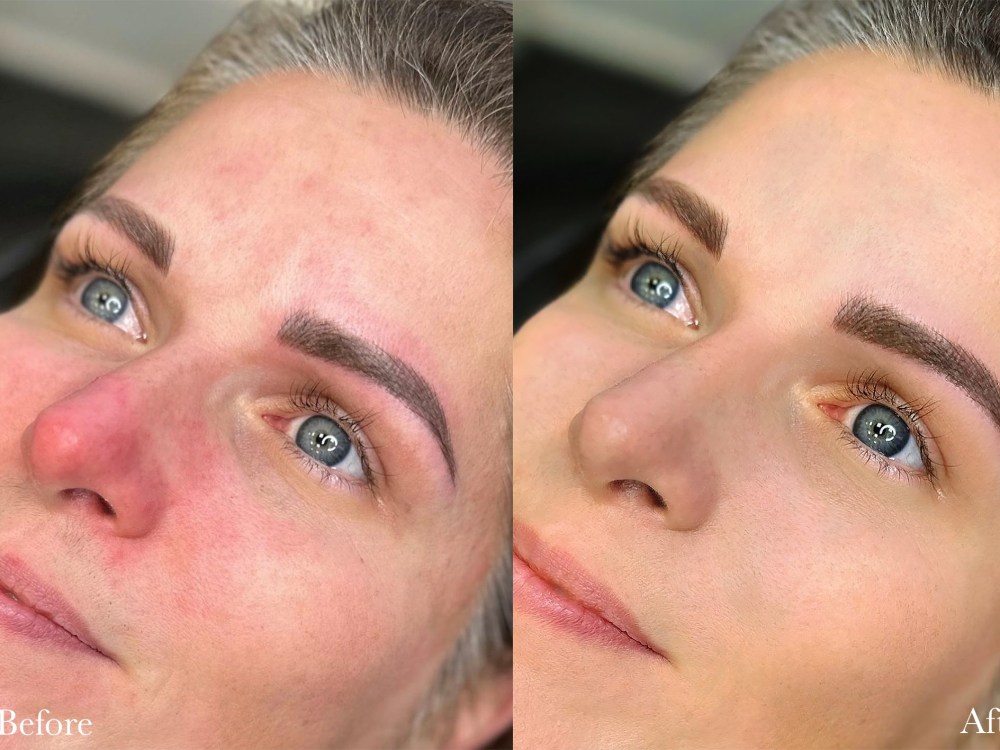 Professional skin, background and color retouching. | Upwork