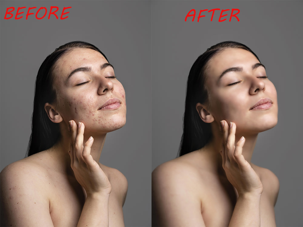 Skin retouching ,smoothing and remove pimples" | Upwork