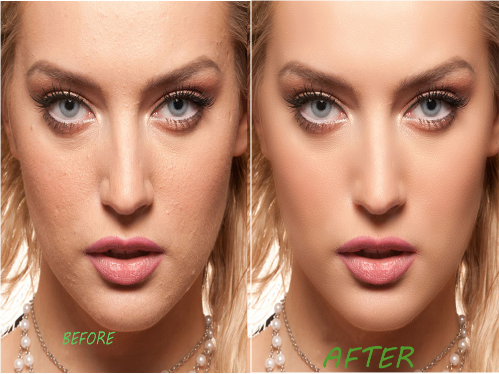 Skin retouching ,smoothing and remove pimples" | Upwork
