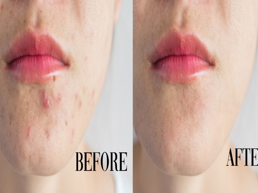 BEST SKIN MODIFICATION - SOFTEN THE SKIN - SKIN RETOUCHING | Upwork