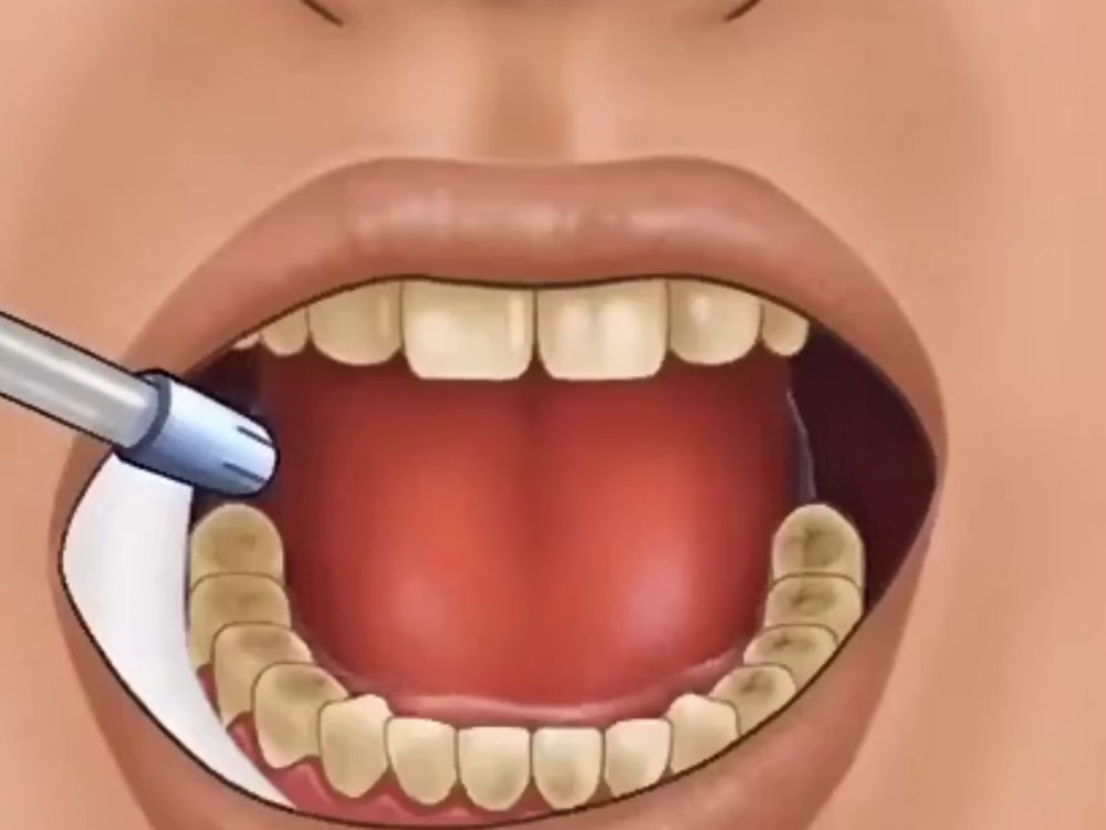 3d medical animation 3d dental animation 3d medical explainer 3d video ...