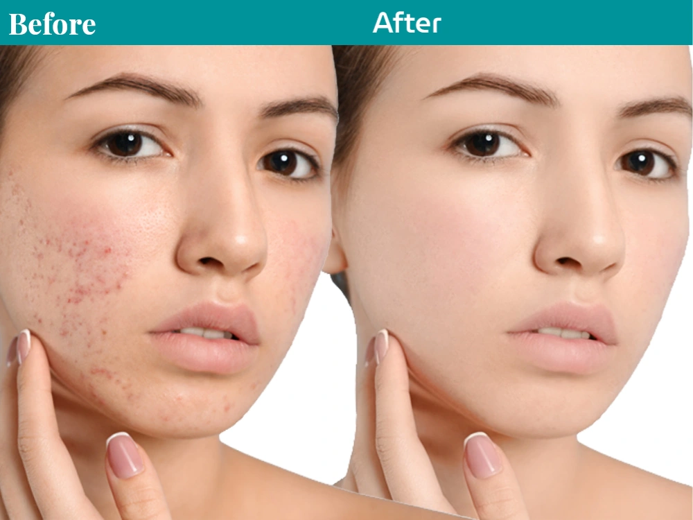 Ai photo Editing, AI image generation, Ai image modification | Upwork