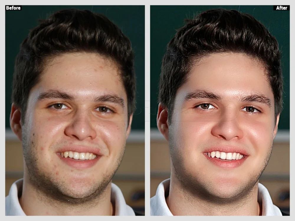 Professional skin retouching in Photoshop | Upwork