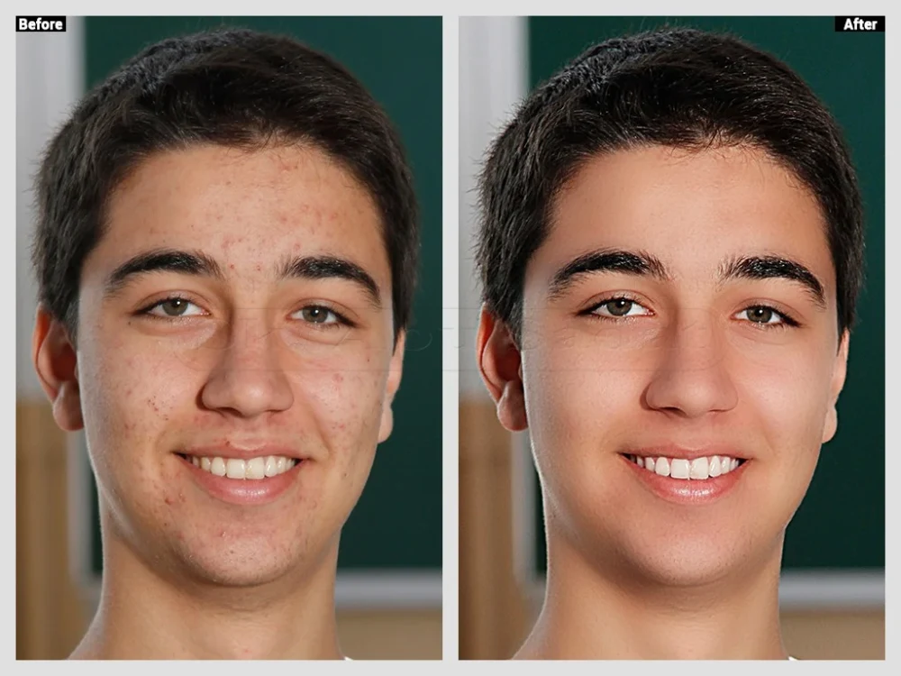 Professional skin retouching in Photoshop | Upwork