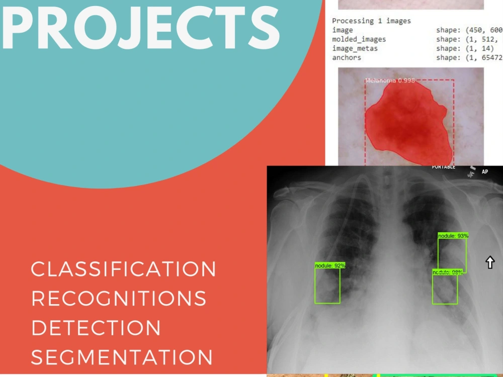 The Machine learning model for classification, Detection and Segmentation. | Upwork
