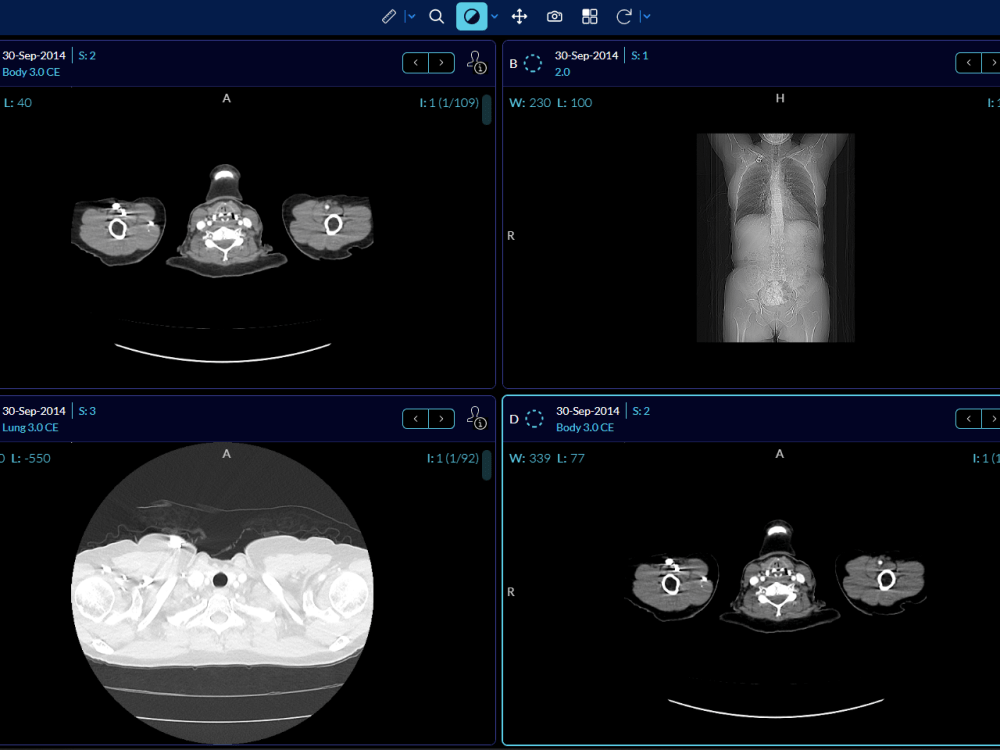 Pacs system with dicom viewer | Upwork