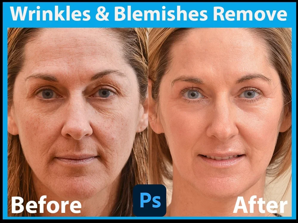 Photo edit, Skin Smoothing, Wrinkle Blemishes removal | Upwork