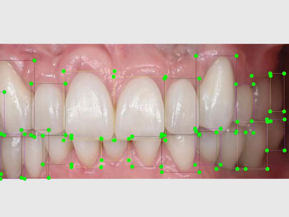 Custom data annotation, bounding box, Image segmentation, data labelling | Upwork