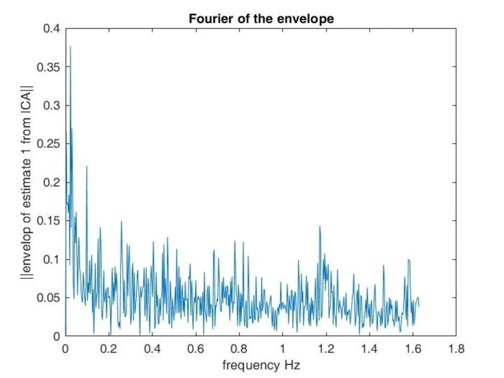 Optimized machine Learning, Neural Networks models with a detailed ...